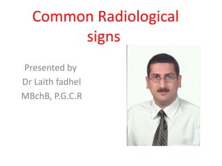 Dr.laith notes about common radiological signs | PPTX