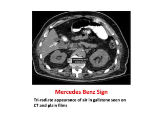 Dr.laith notes about common radiological signs | PPTX