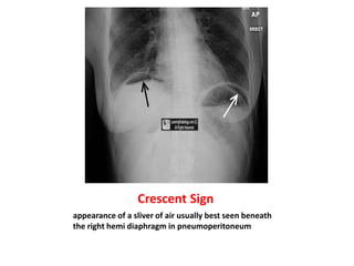 Dr.laith notes about common radiological signs | PPTX