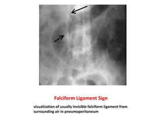 Dr.laith notes about common radiological signs | PPTX