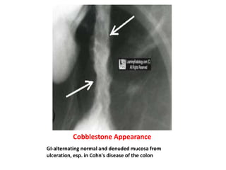 Dr.laith notes about common radiological signs | PPTX