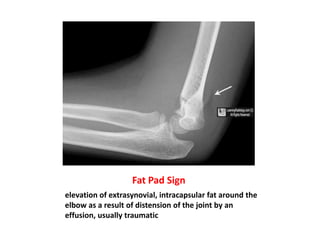 Dr.laith notes about common radiological signs | PPTX