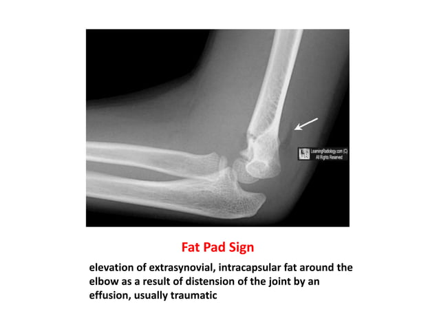 Dr.laith notes about common radiological signs | PPTX