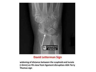 Dr.laith notes about common radiological signs | PPTX