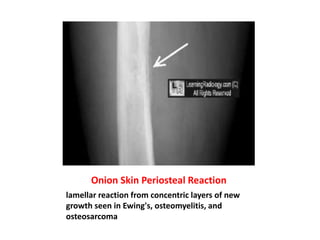 Dr.laith notes about common radiological signs | PPTX