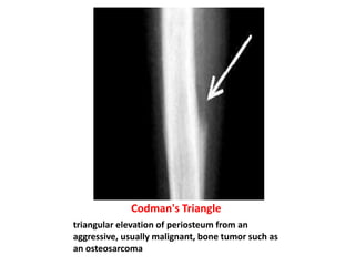 Dr.laith notes about common radiological signs | PPTX