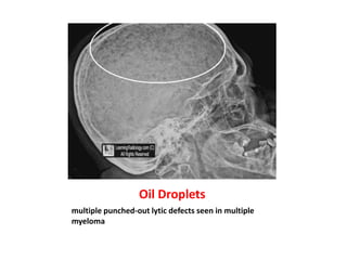 Dr.laith notes about common radiological signs | PPTX