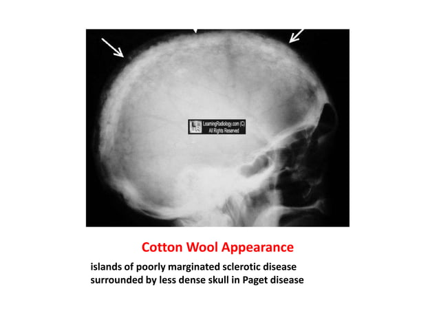 Dr.laith notes about common radiological signs | PPTX