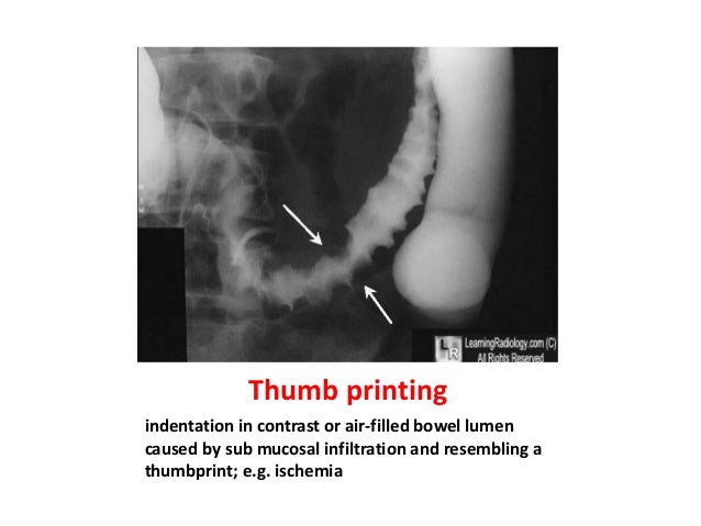 Dr.laith notes about common radiological signs
