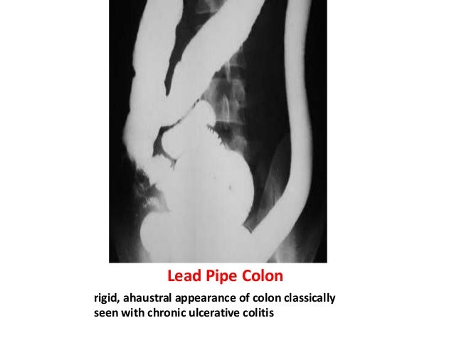 Dr.laith notes about common radiological signs