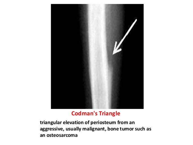Dr.laith notes about common radiological signs