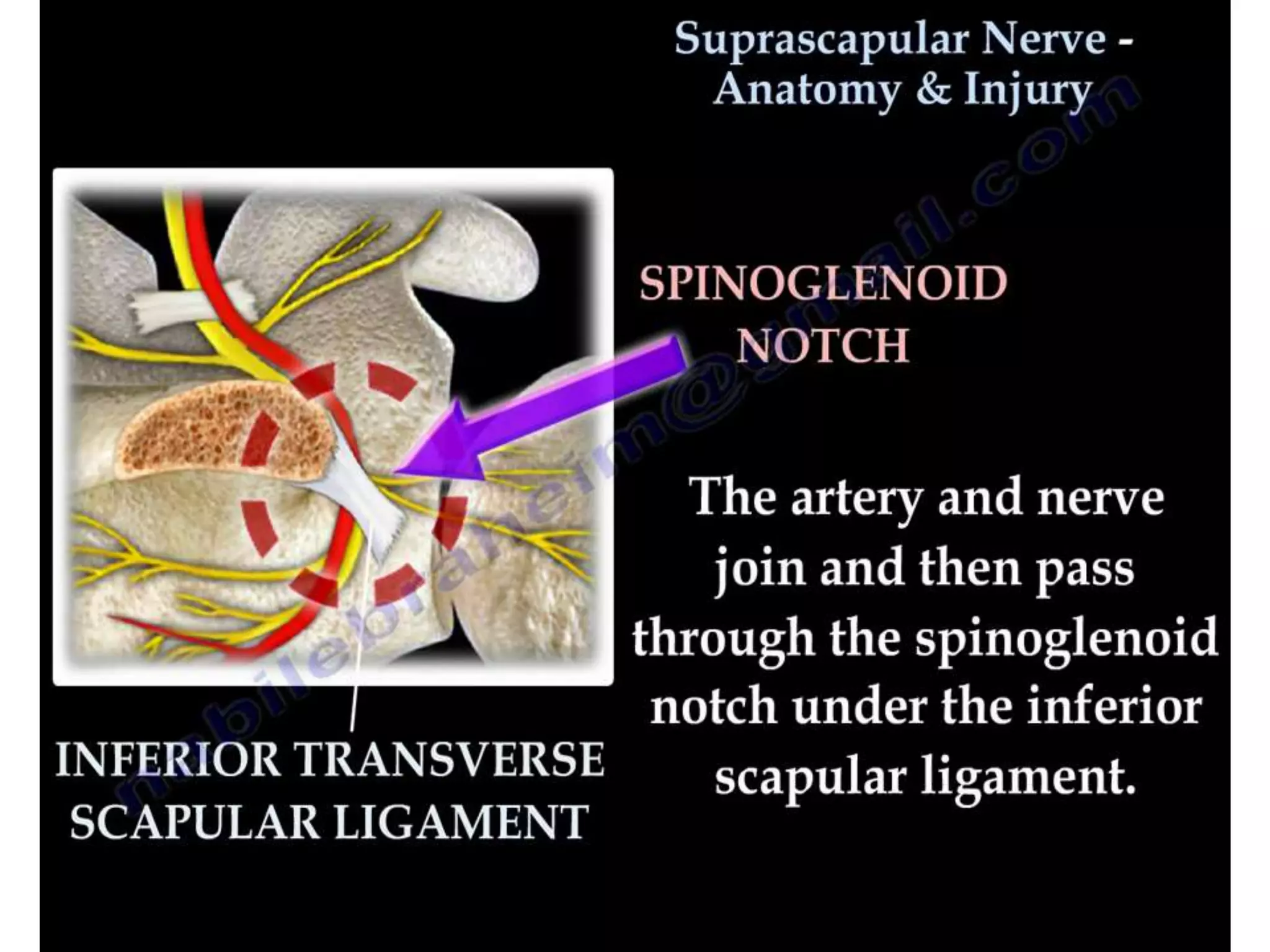 Spinal Entrapment Syndrome – Femoral Nerve Entrapment Syndrome – BOXB