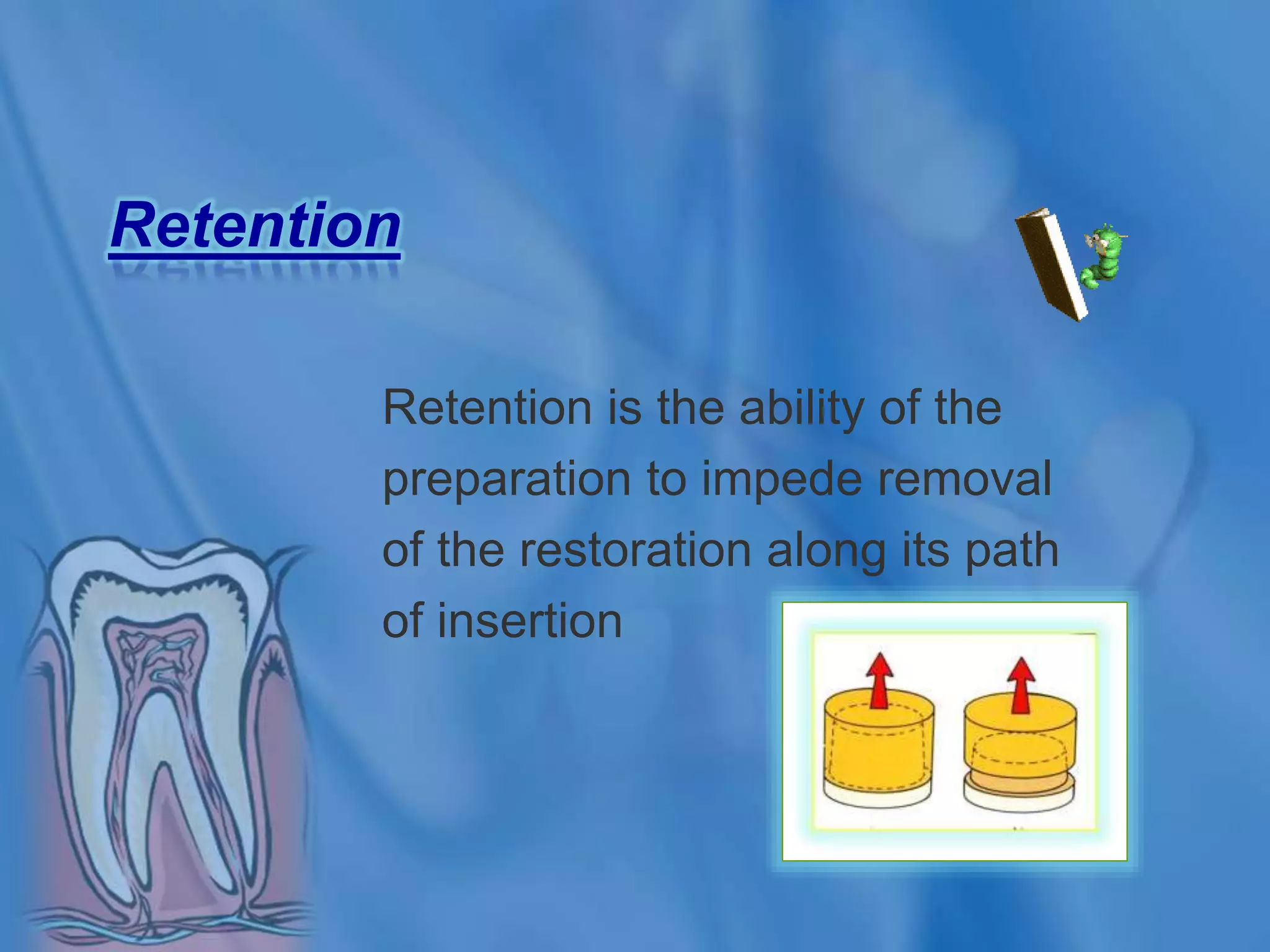 class II cast metal restorations | PPTX