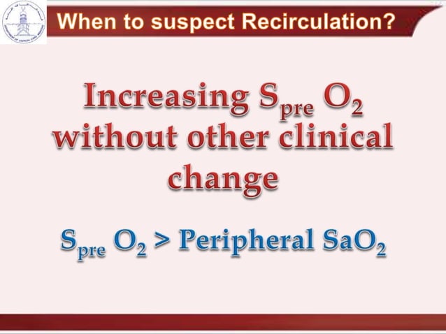 cannulation and recirculation in vv ecmo | PPTX | First Aid | Injuries