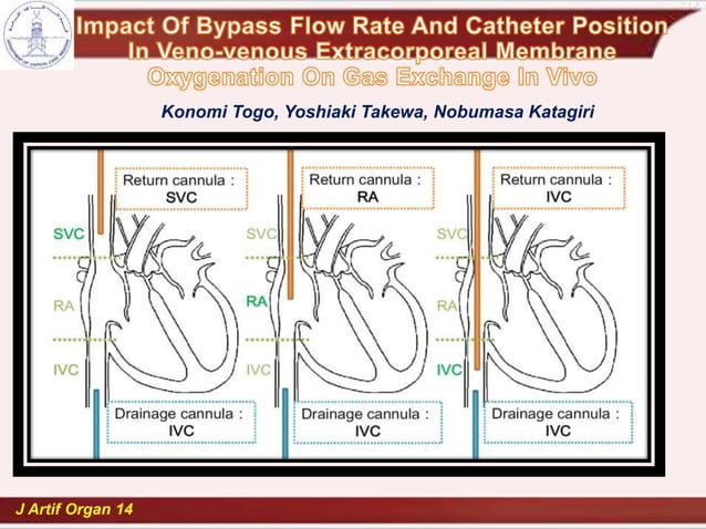cannulation and recirculation in vv ecmo | PPTX | First Aid | Injuries