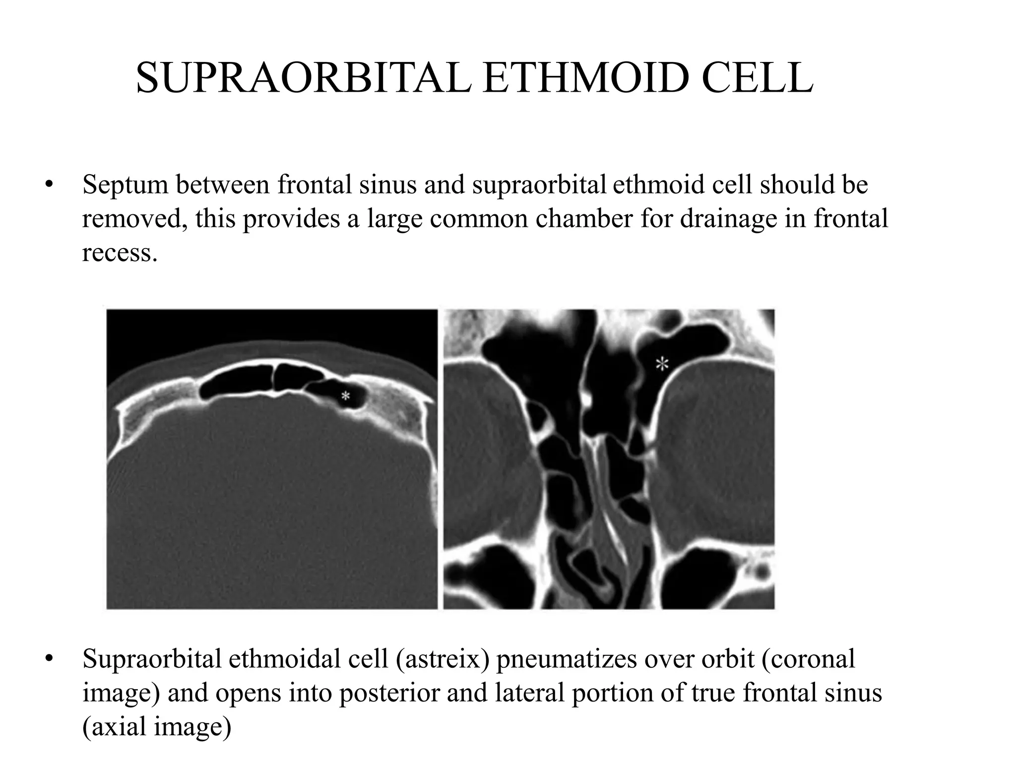 surgical approaches to frontal sinus ppt | PPTX