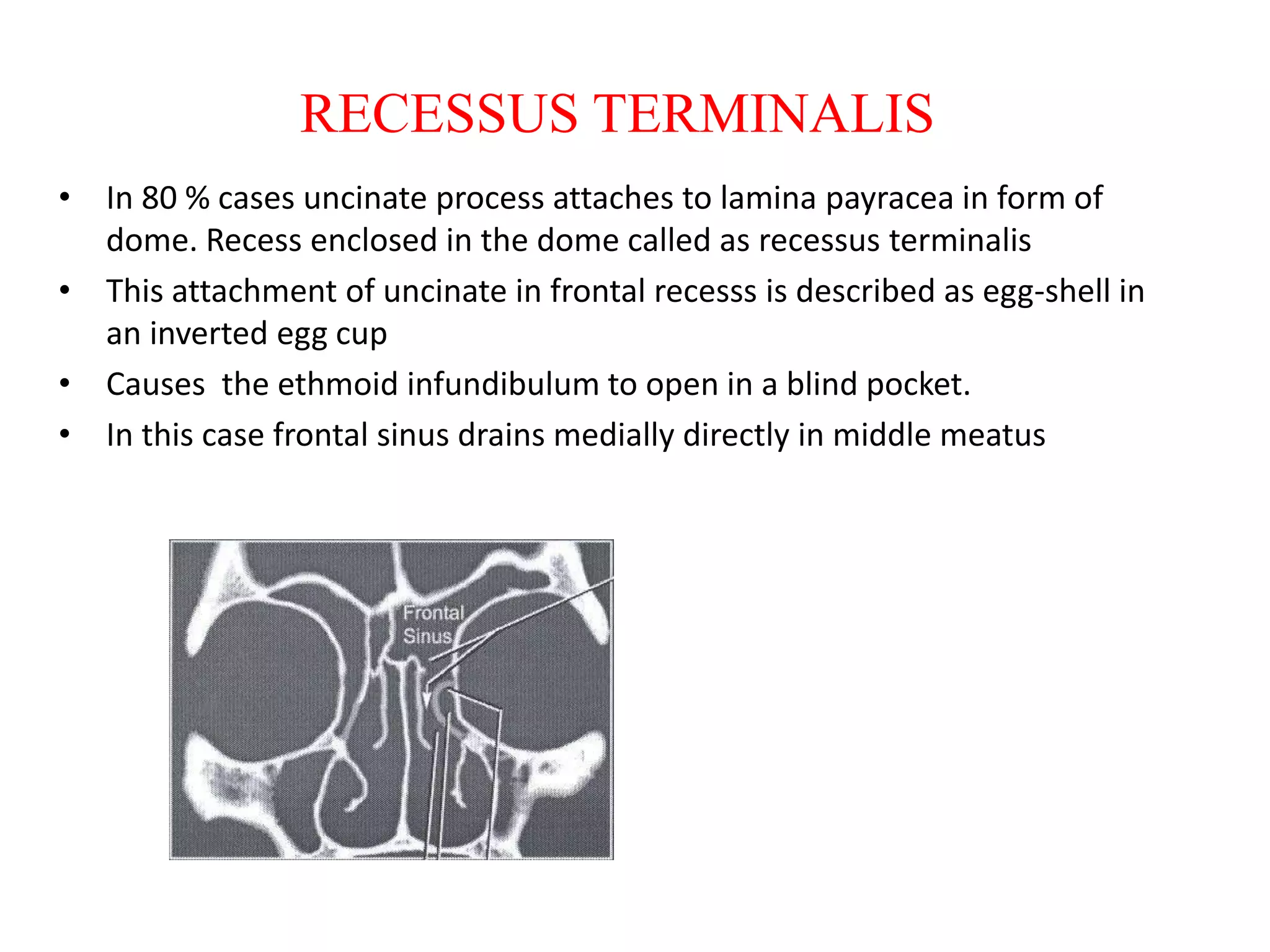 surgical approaches to frontal sinus ppt | PPTX