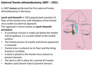 surgical approaches to frontal sinus ppt | PPTX
