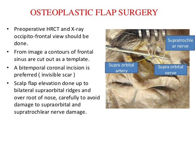 surgical approaches to frontal sinus ppt