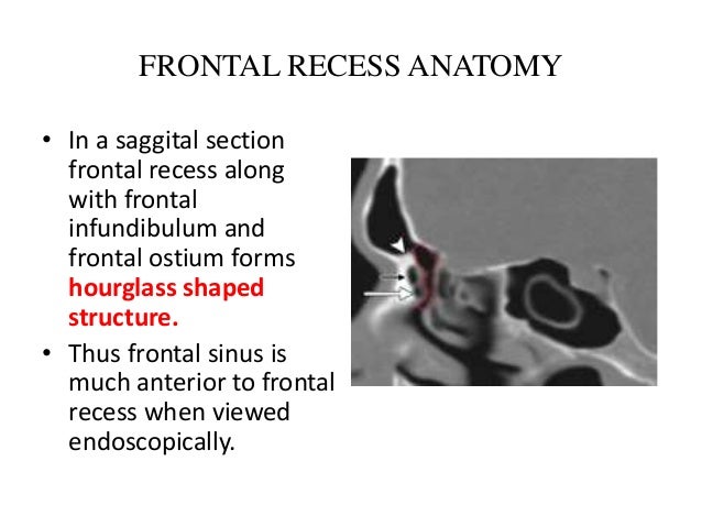 surgical approaches to frontal sinus ppt
