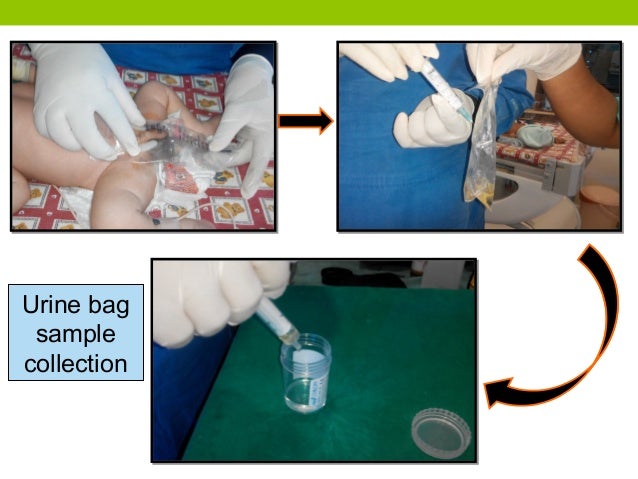 Microbiological testing in neonatal intensive unit.
