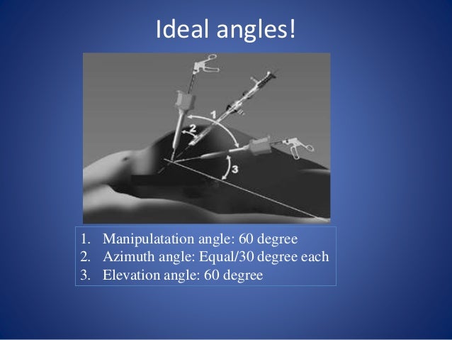 Laparoscopy & its Ergonomics by Dr.Mohammad Zarin
