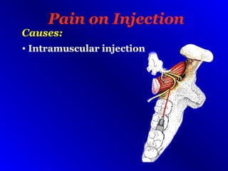 Dr. maged omar local anesthesia complications 4thy lec1 | PPT