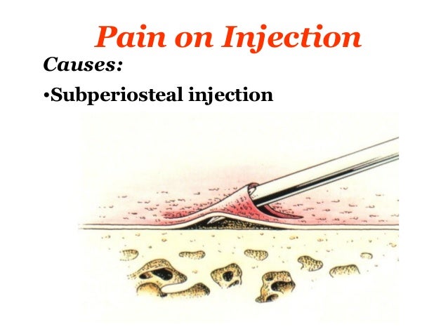 Dr. maged omar local anesthesia complications 4thy lec1