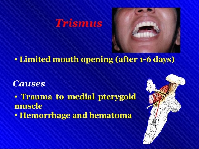 Dr. maged omar local anesthesia complications 4thy lec1