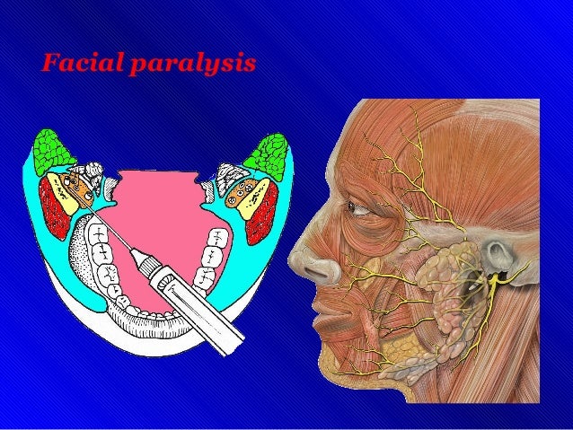 Dr. maged omar local anesthesia complications 4thy lec1