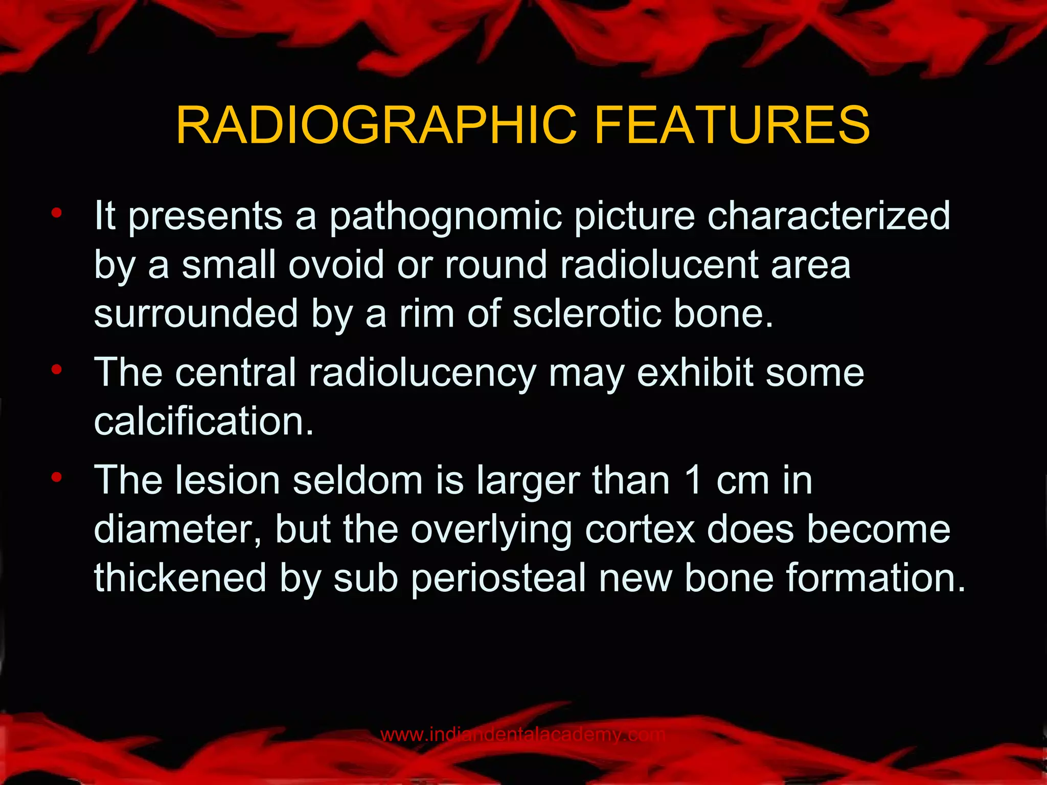 osteoid osteoma of the jaw /dental courses | PPT