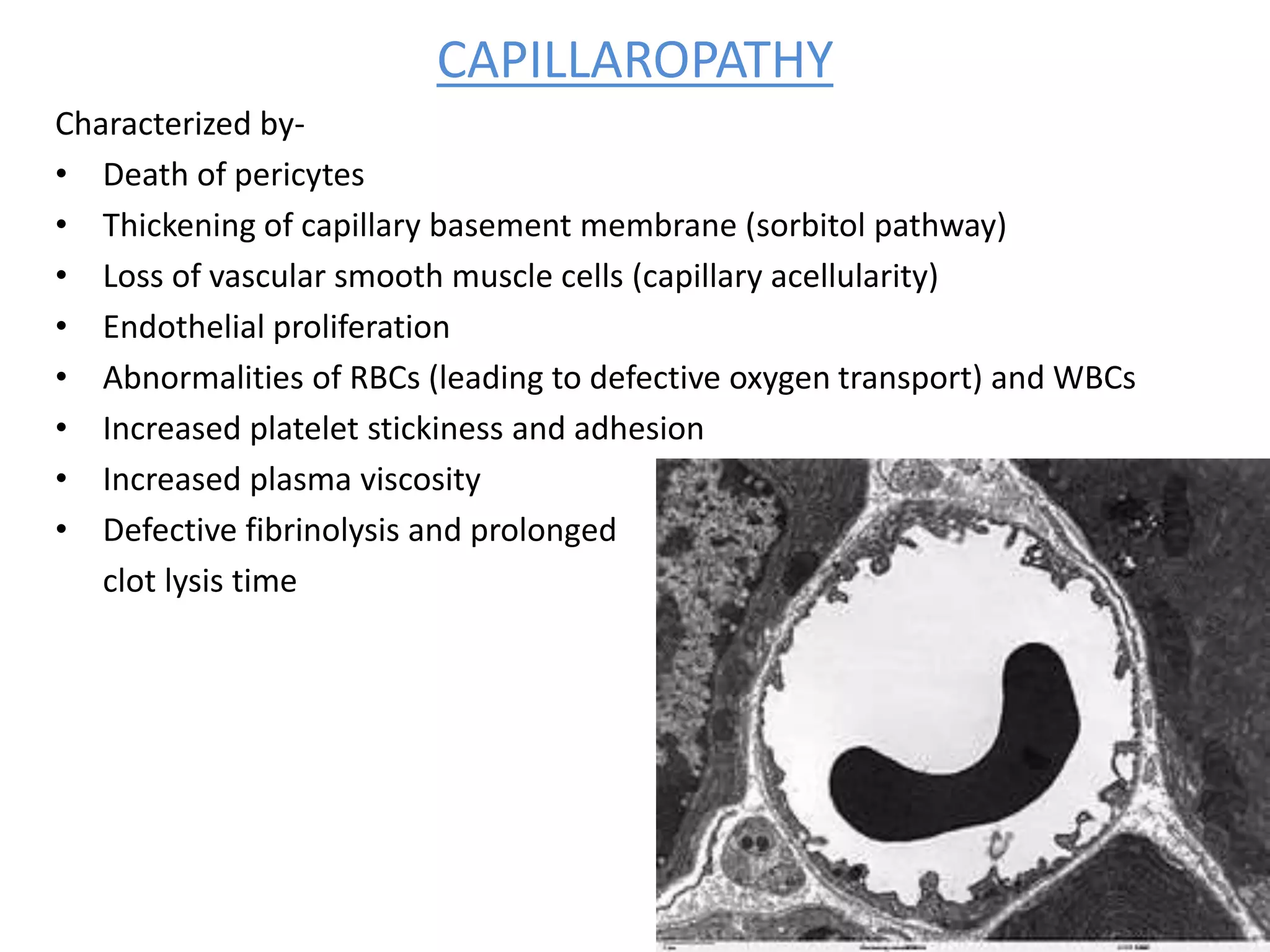 Diabetic retinopathy | PPTX