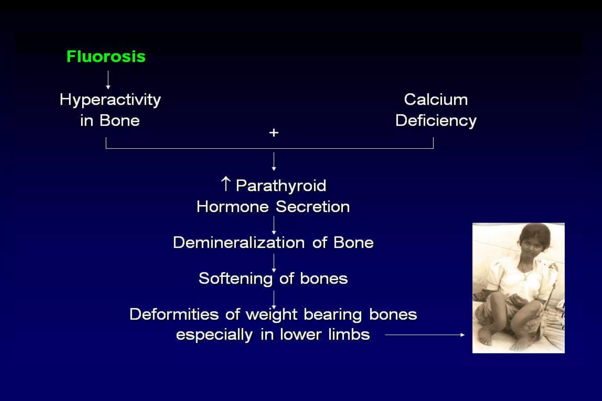 Fluorosis in India with its preventive measurement | PPT