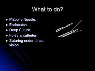 Dr. mahesh patwardhan complications of laparoscopic surgery | PDF