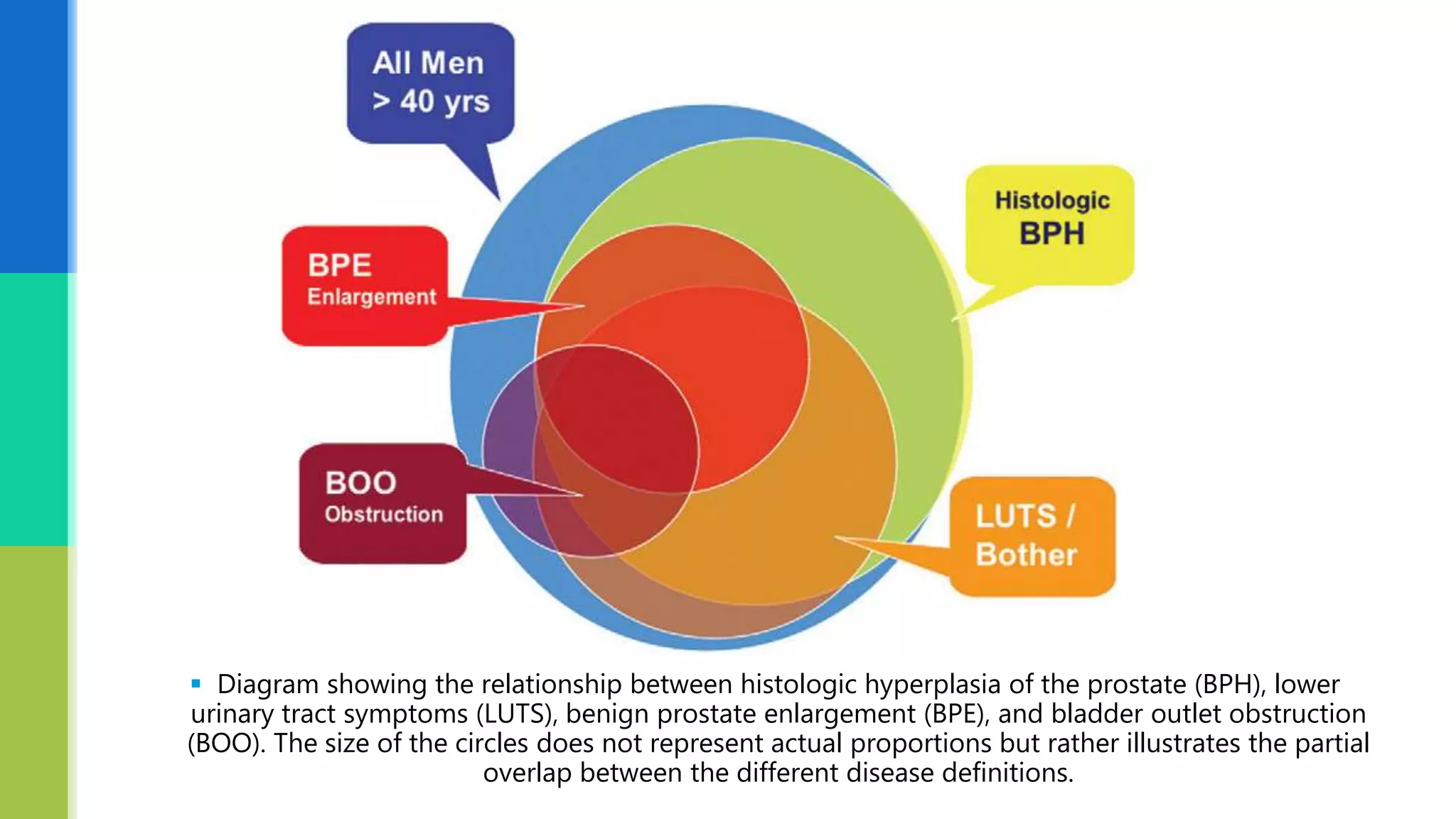 BPH- Pathology & Investigations | PPTX