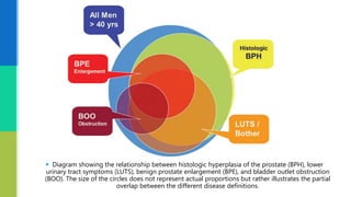 BPH- Pathology & Investigations | PPT