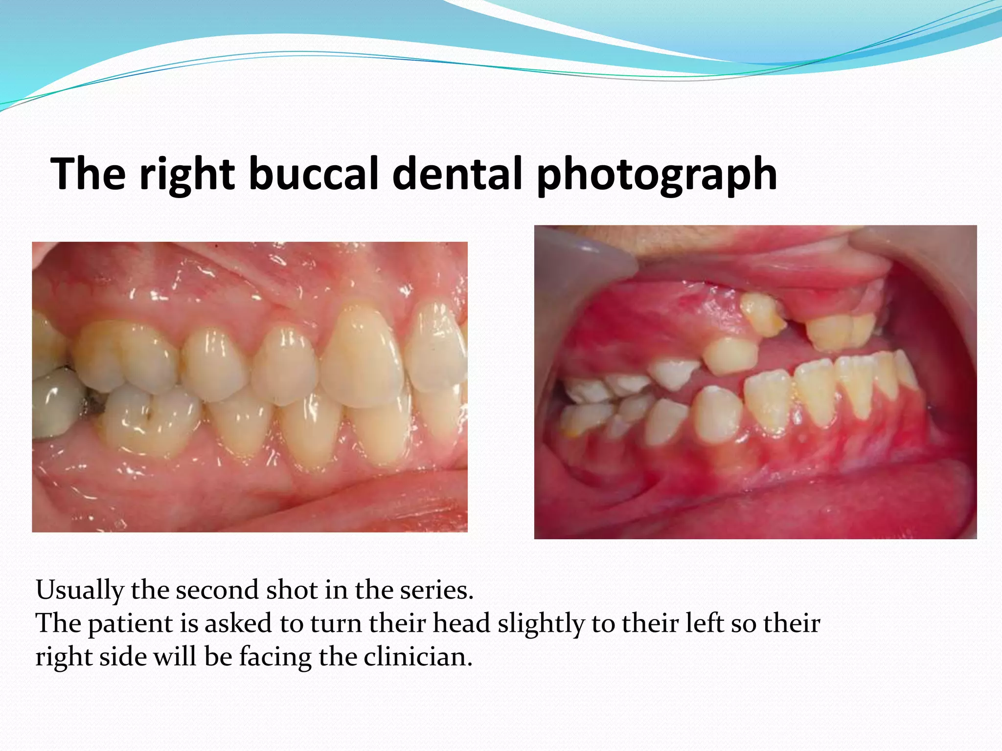 Clinical Digital Photography in Orthodontics | PPTX