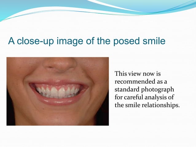 Clinical Digital Photography in Orthodontics | PPTX | Cameras and Camcorders | Consumer Electronics