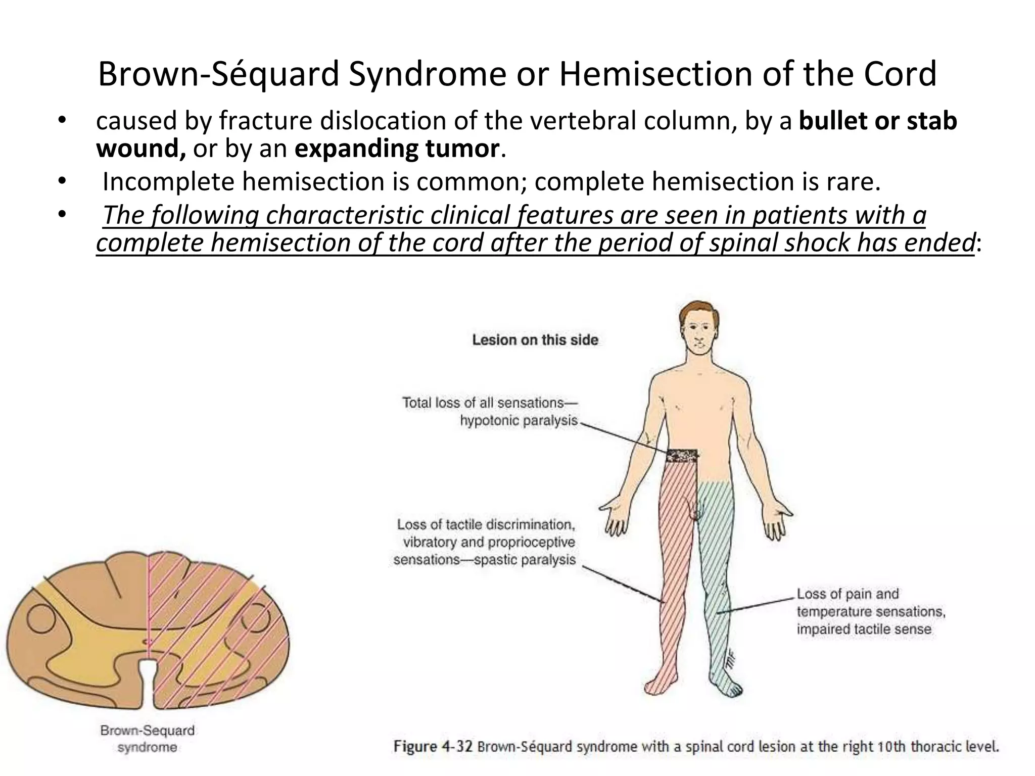 spinal cord and applied aspects of spine | PPTX