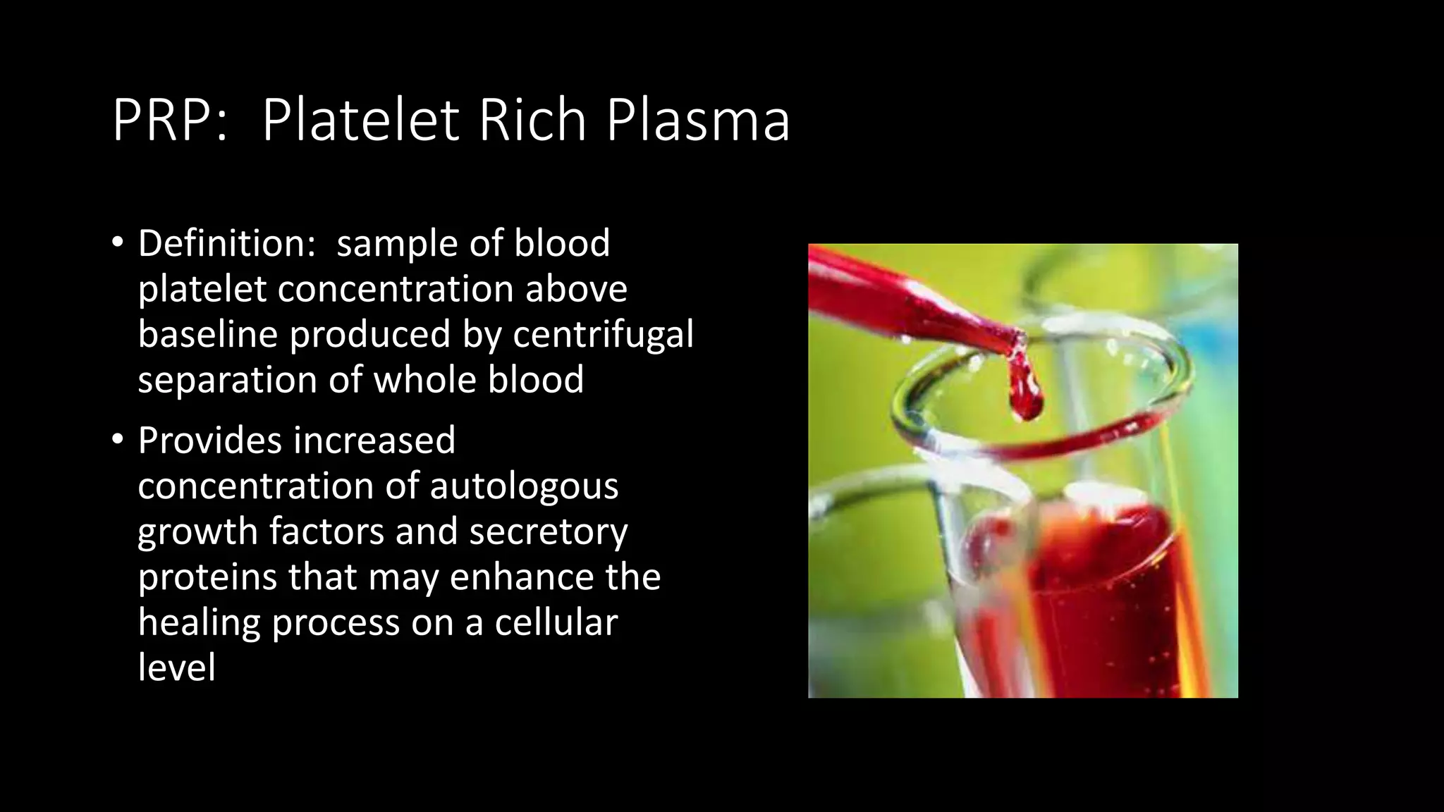 PRP Update: From basic science to clinical application | PPTX | Blood ...