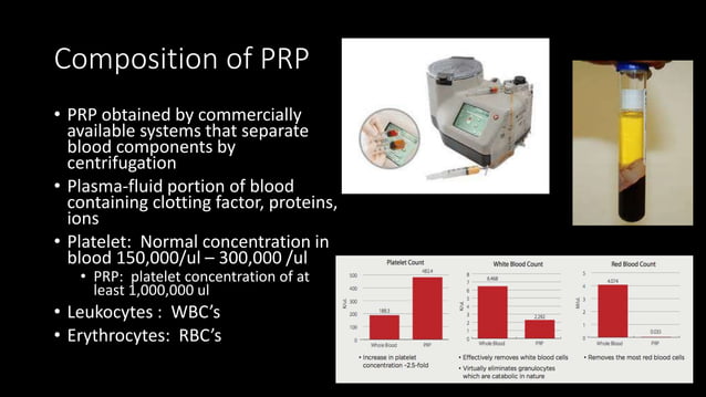 PRP Update: From basic science to clinical application | PPTX | Blood ...