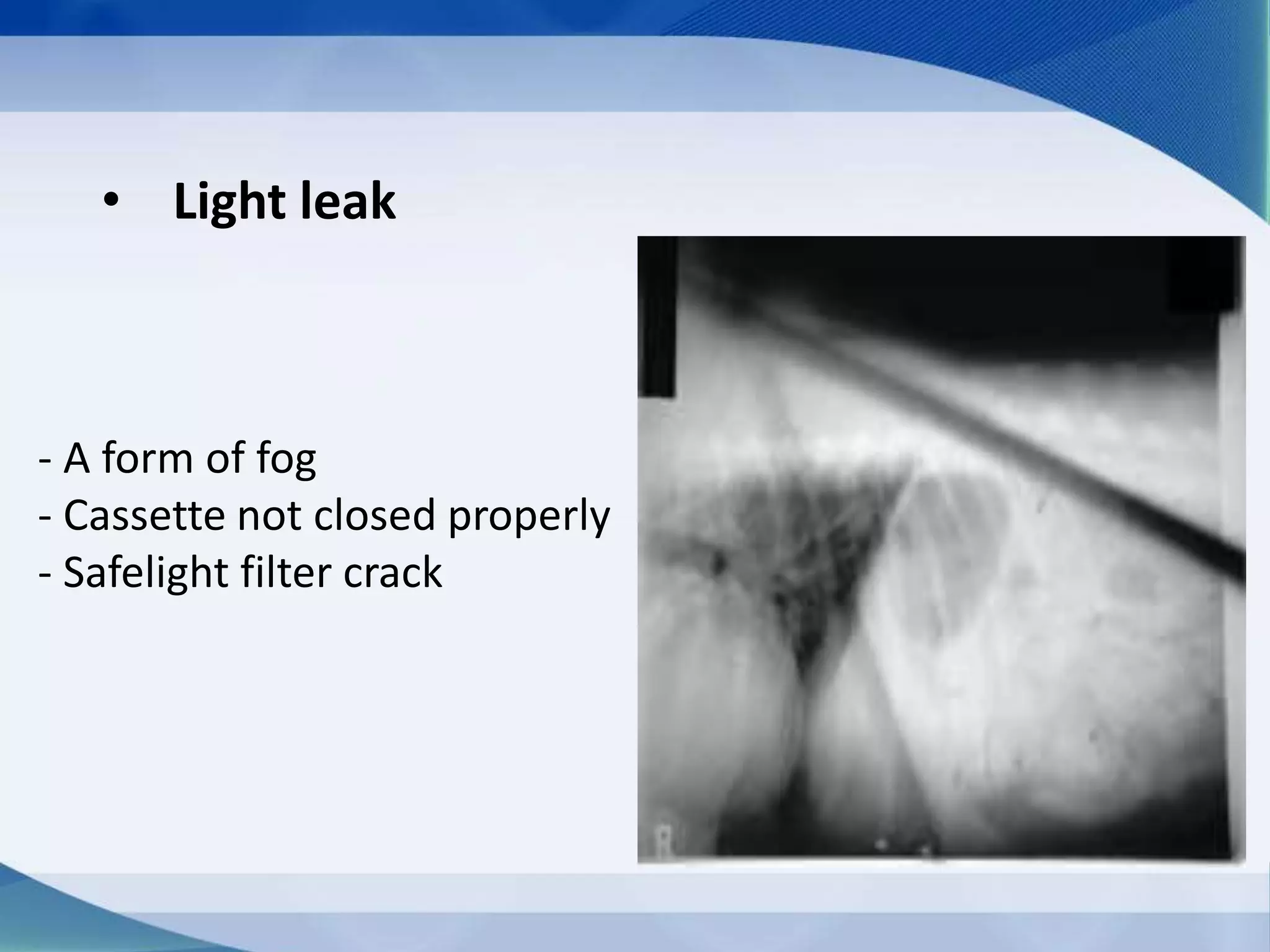 Radiographic artifacts | PPTX