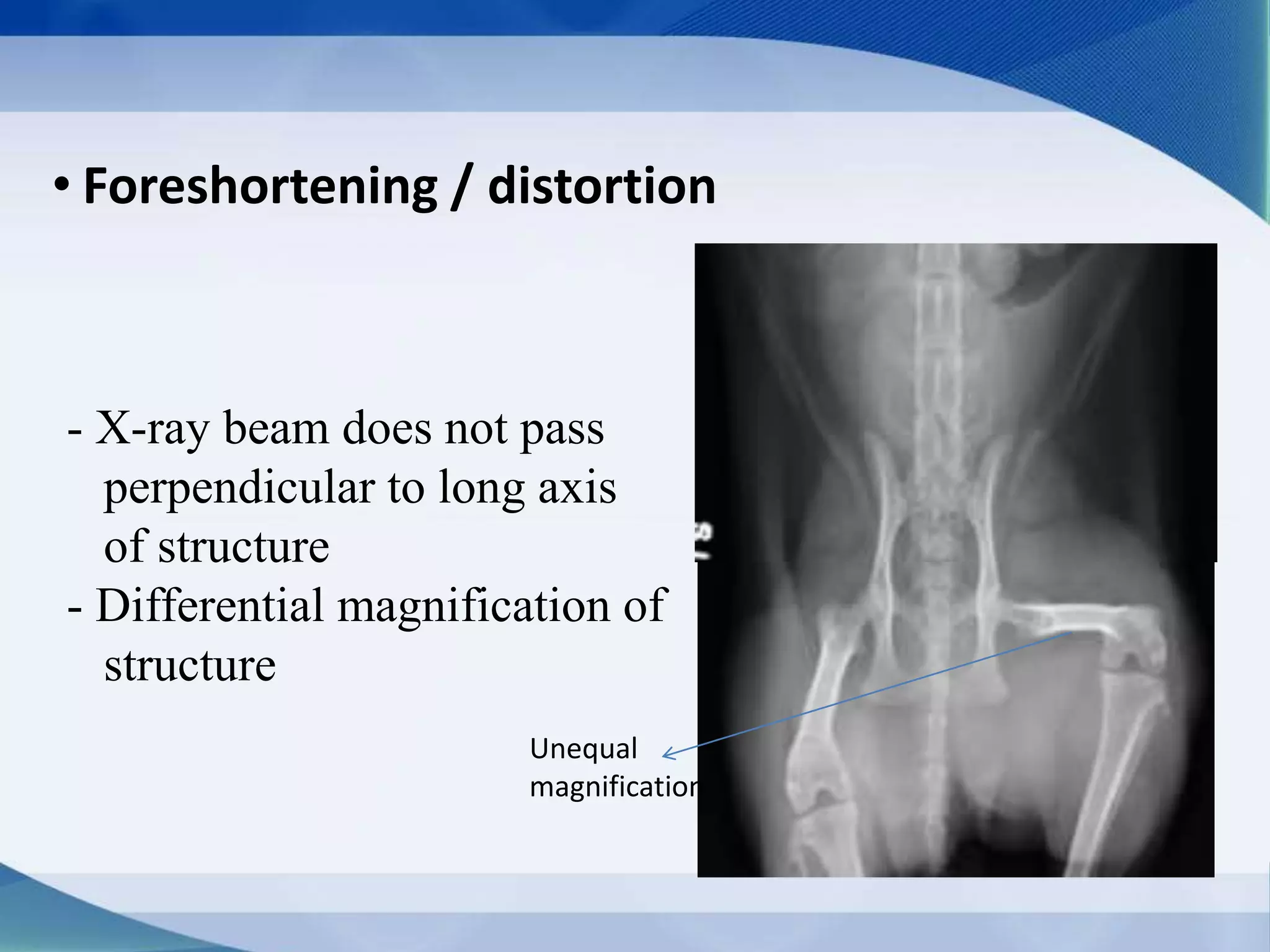 Radiographic artifacts | PPTX