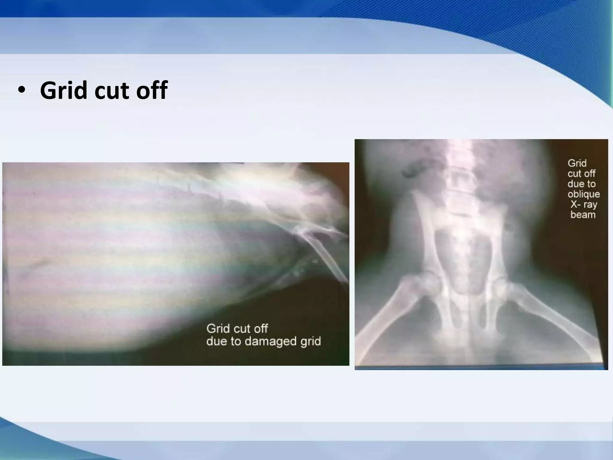 Radiographic artifacts | PPTX