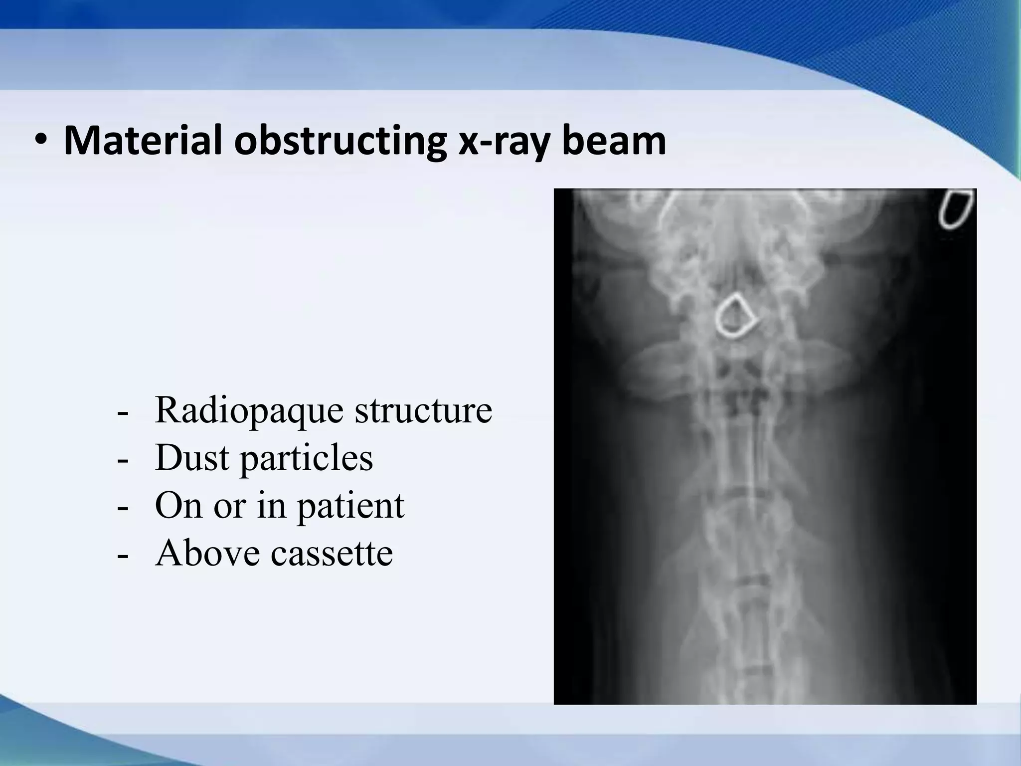 Radiographic artifacts | PPTX