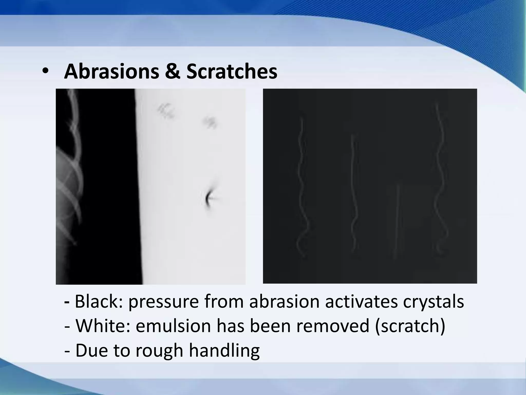 Radiographic artifacts | PPTX