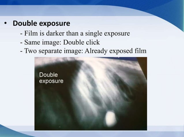Radiographic artifacts | PPTX