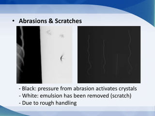 Radiographic artifacts | PPTX