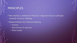 functional cast bracing -sarmiento ,ptb cast -s.senthil sailesh | PPTX