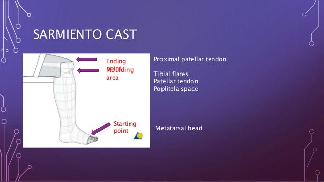 functional cast bracing -sarmiento ,ptb cast -s.senthil sailesh